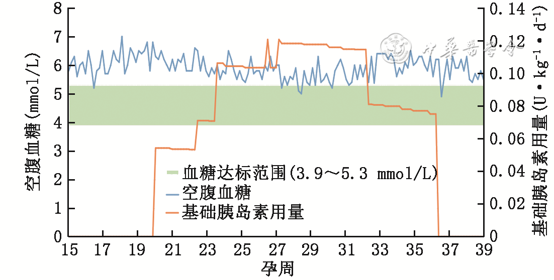 GCK-MODY孕期个体化治疗和血糖波动特征分析1例