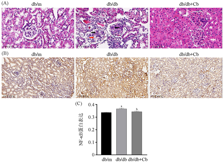 酪酸梭菌对db/db小鼠肾组织的保护作用及机制