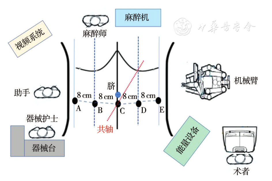 达芬奇机器人手术系统辅助保留幽门及迷走神经的胃部分切除术